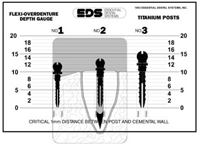 Flexi-Post Overdenture Attachment® - zaczepy do mocowania protez ...